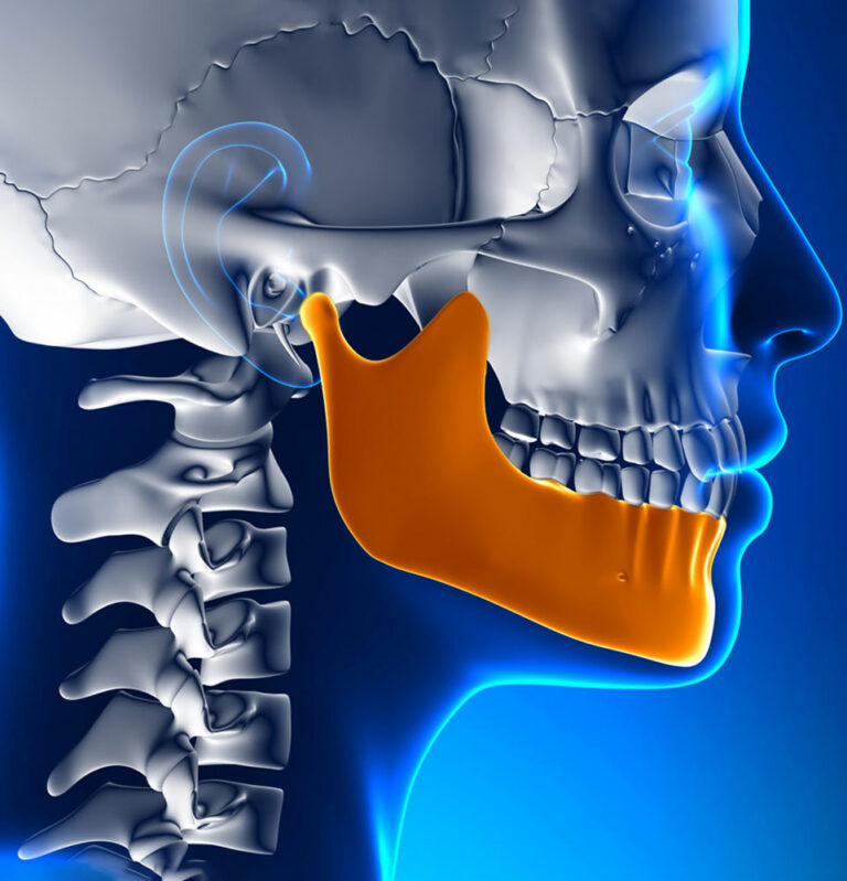 TMJ Specialist Near Me | Dental BOTOX for Jaw Pain & TMJ Relief